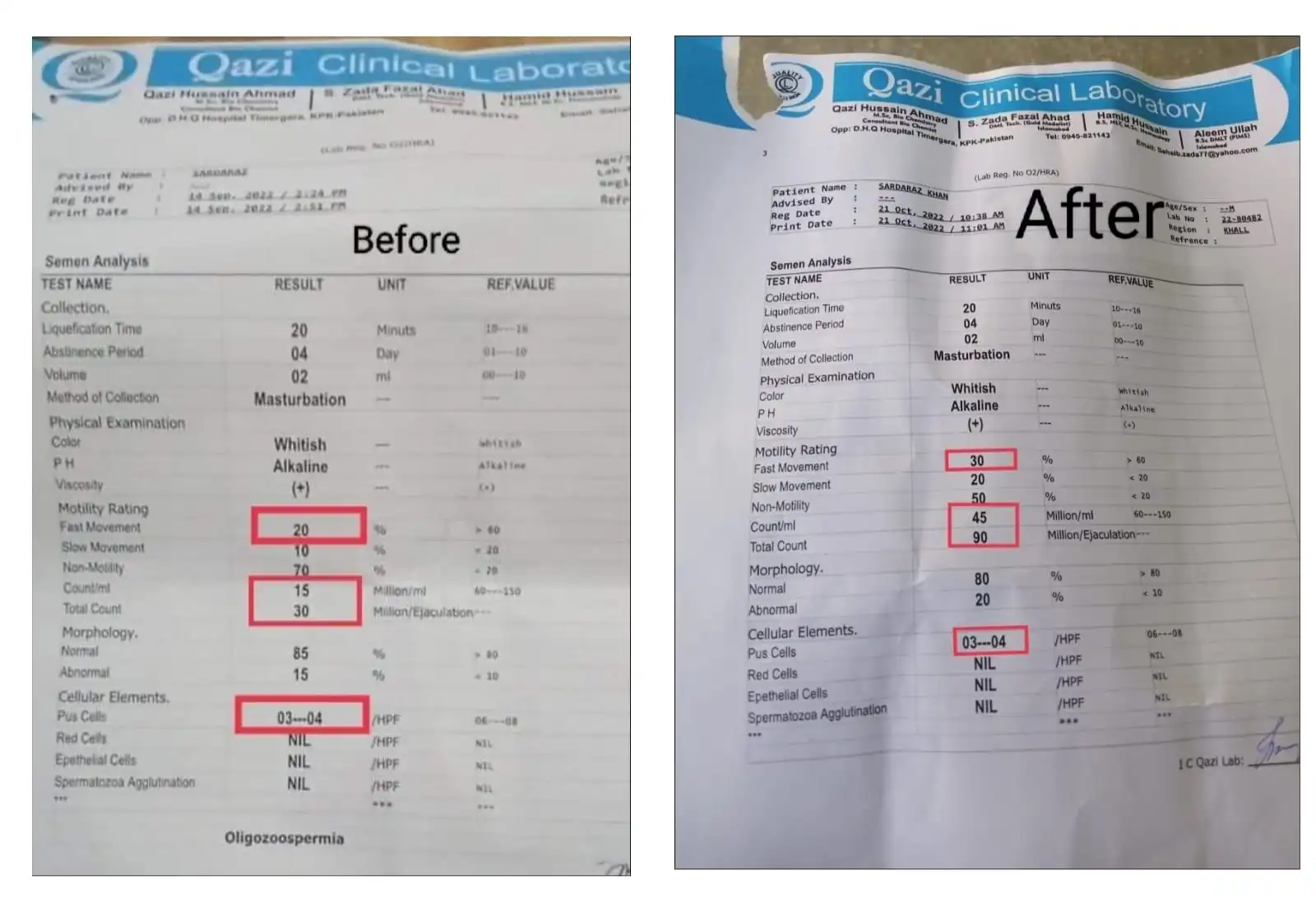 Sperm Plus Tablets - Boost Fertility and Improve Male Potency