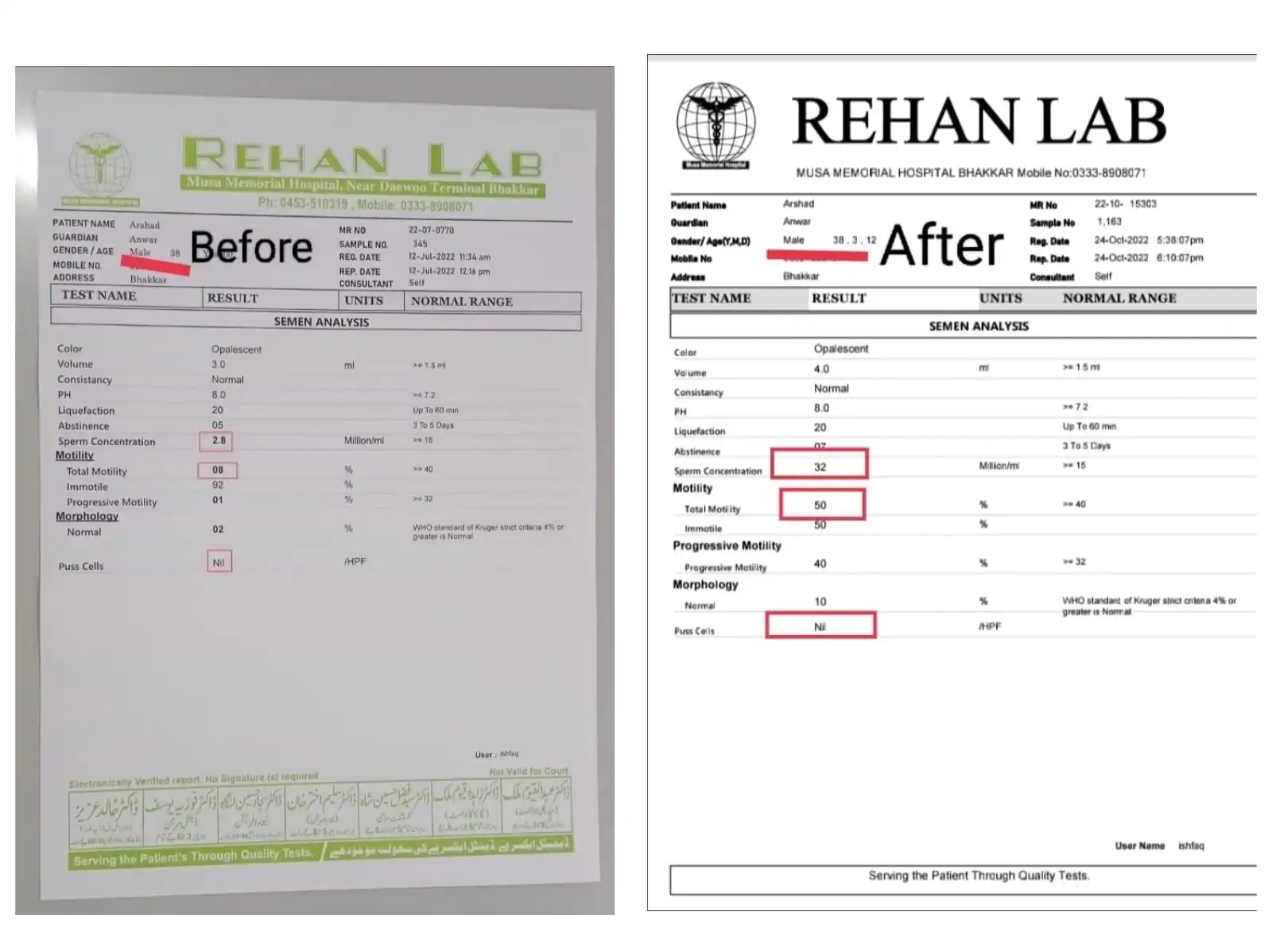 Sperm Plus Tablets - Boost Fertility and Improve Male Potency