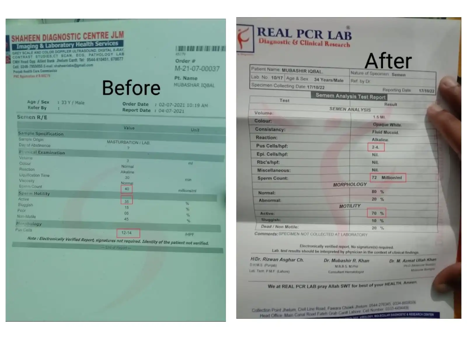 Sperm Plus Tablets - Boost Fertility and Improve Male Potency